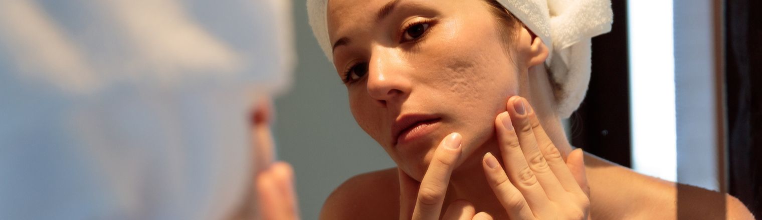 How to Identify Sensitive Skin - Signs and Tips | Simple Skincare