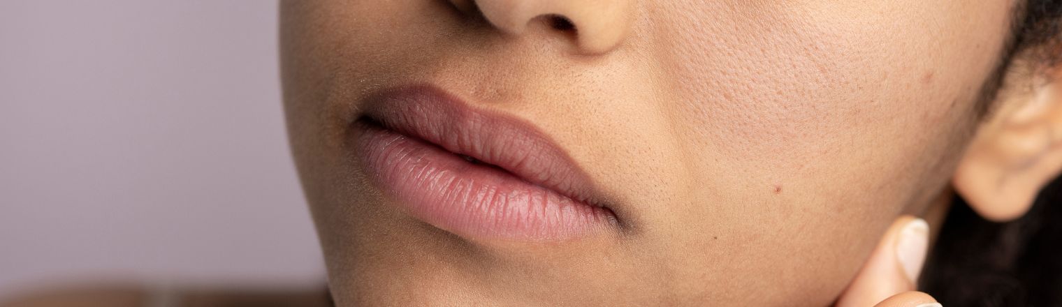 How To Reduce Redness On Face?